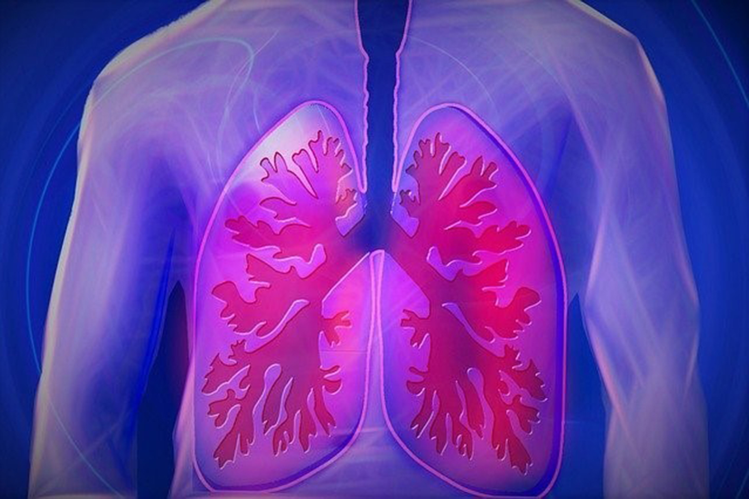 ¿Existe relación entre el cáncer de pulmón y la mala calidad del aire?